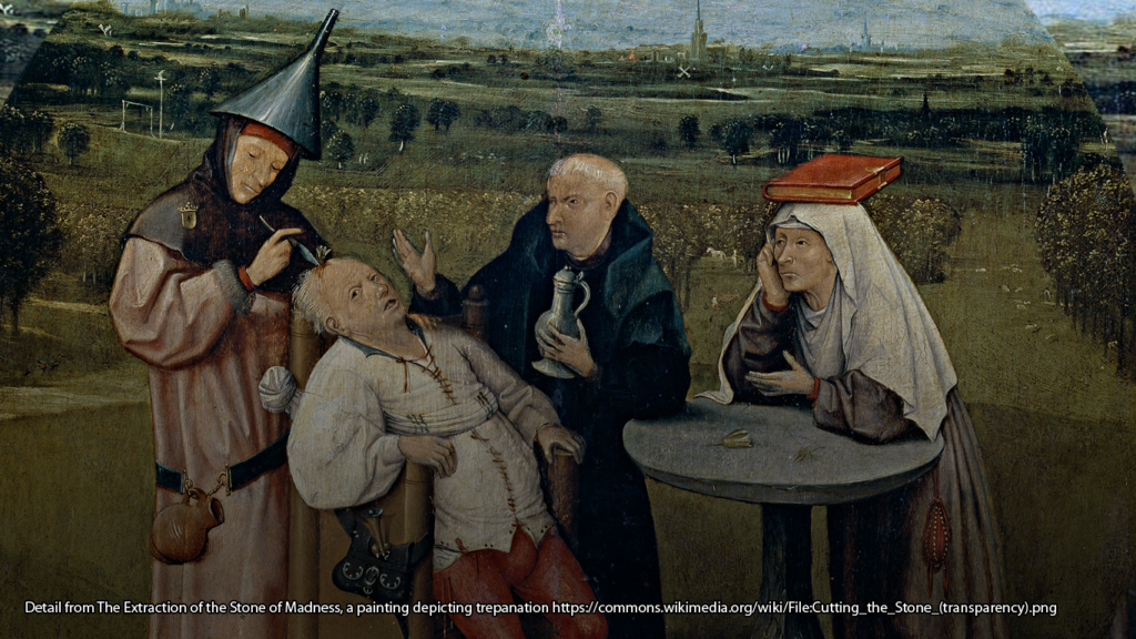 Magic, Myth & Medicine in the Calvin Wells Archive – #FolkloreThursday